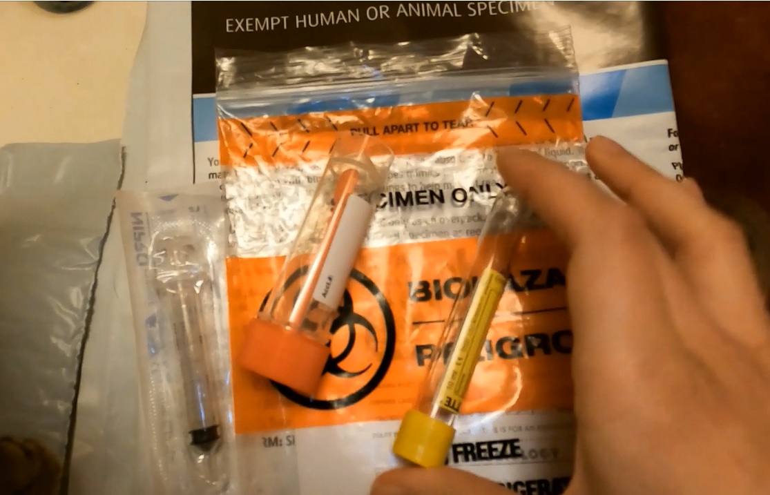 Routine Vet Care for Cats Preventive Tests Bloodwork DNA and more